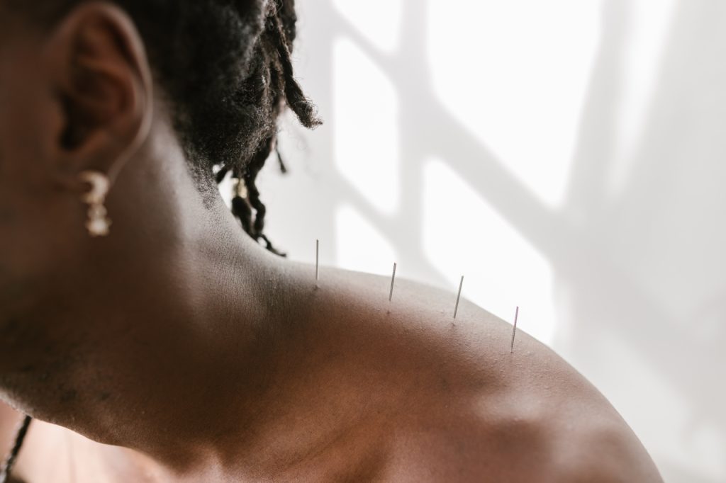 Acupuncture for Shoulder Pain - American Institute of Alternative Medicine