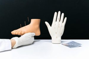 Acupuncture Points: What You Need To Know - American Institute of ...